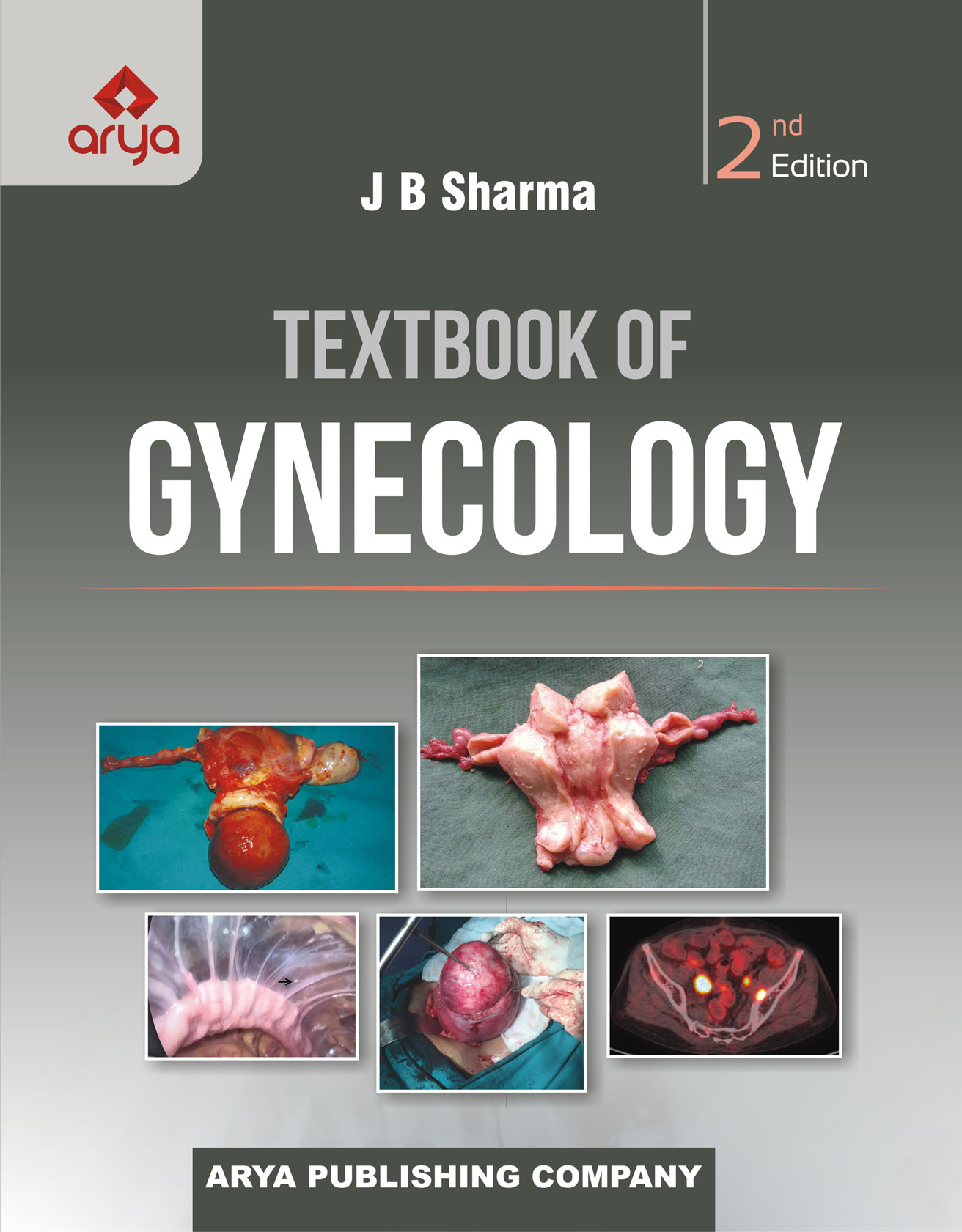 Textbook of Gynecology 2nd/2022 - Best Online Medical Book Store