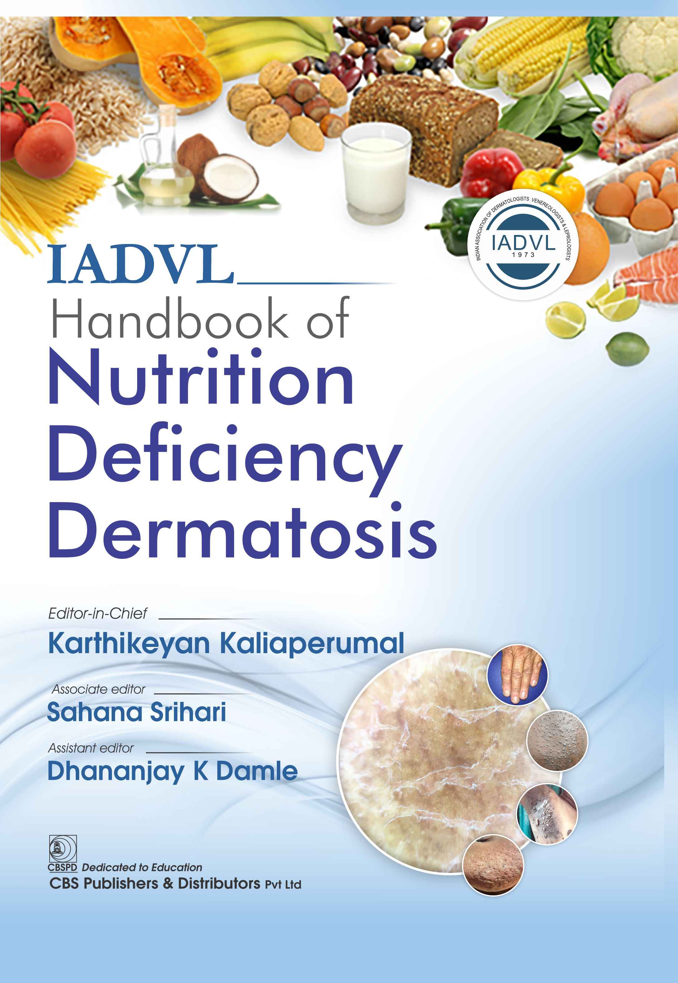 IADVL Handbook of Nutrition Deficiency Dermatosis 1st/2025 - Best ...