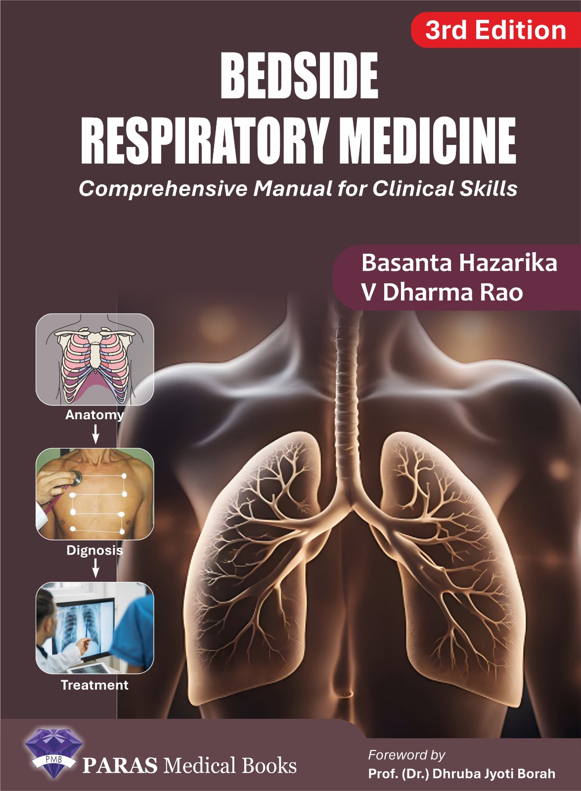 Bedside Respiratory Medicine 3rd/2025 - Best Online Medical Book Store